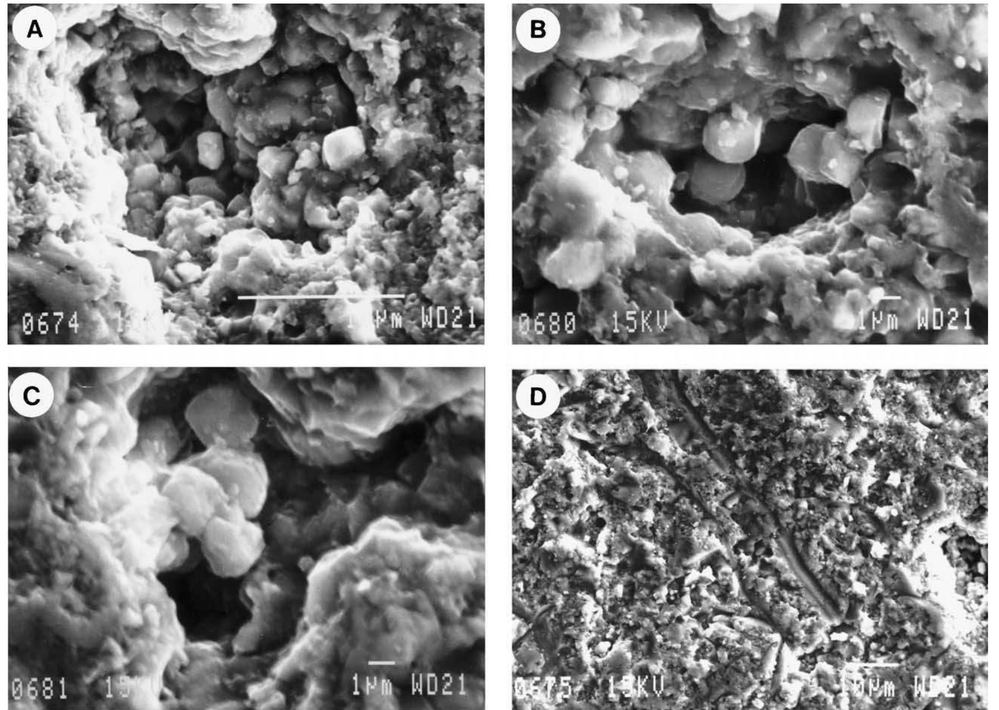 Scanning electron microscopic photomicrograph (sem-se image)
