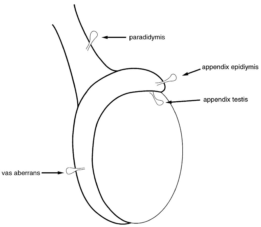 (PDF) Ultrasound appearances of the testicular appendages: pictorial review