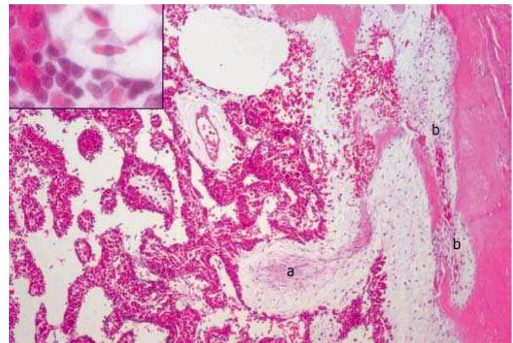 Humerus, transversal section of the metaphysis, he stain, 40