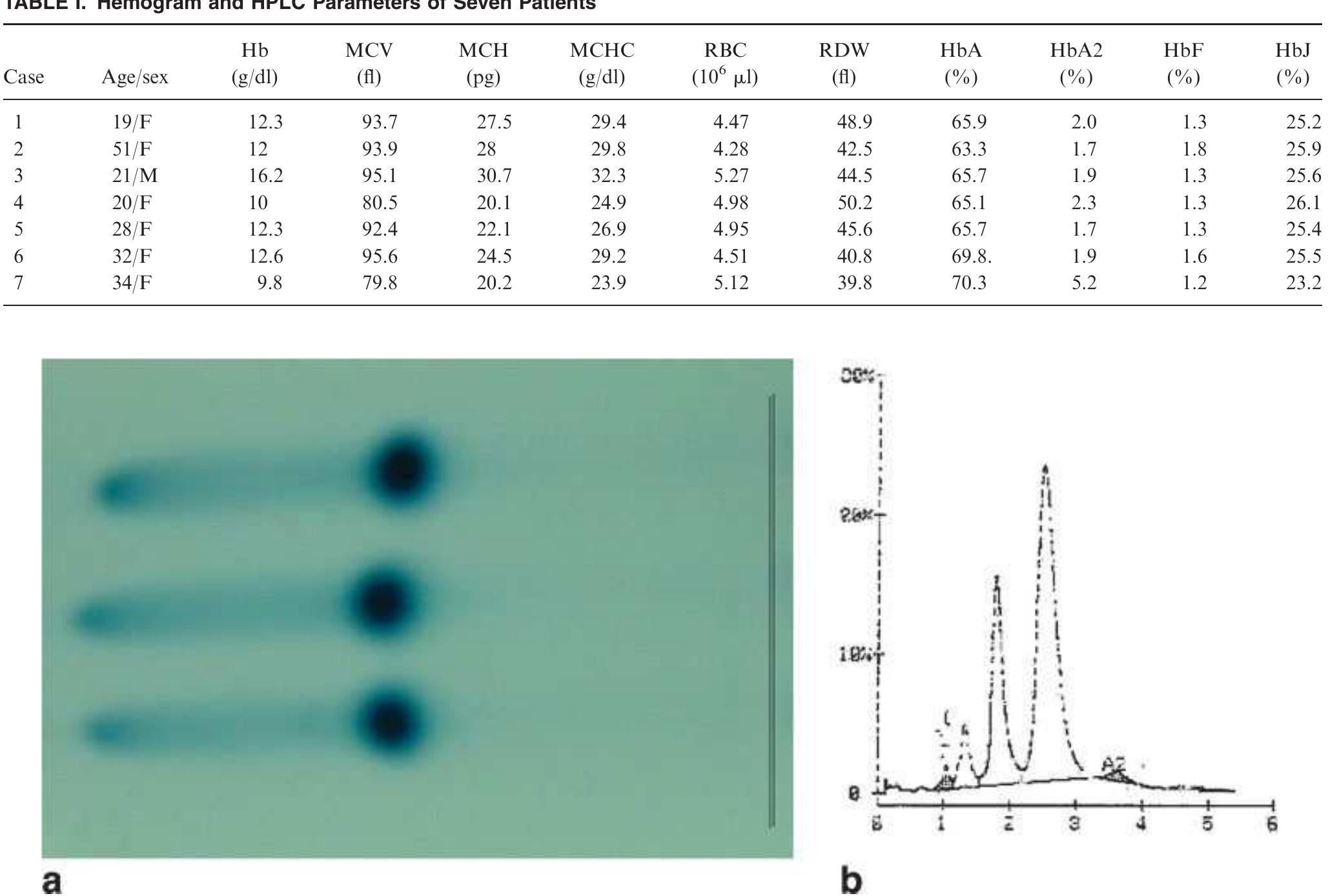 (PDF) Hb J Meerut, a fast-moving hemoglobin—a study of seven cases from ...