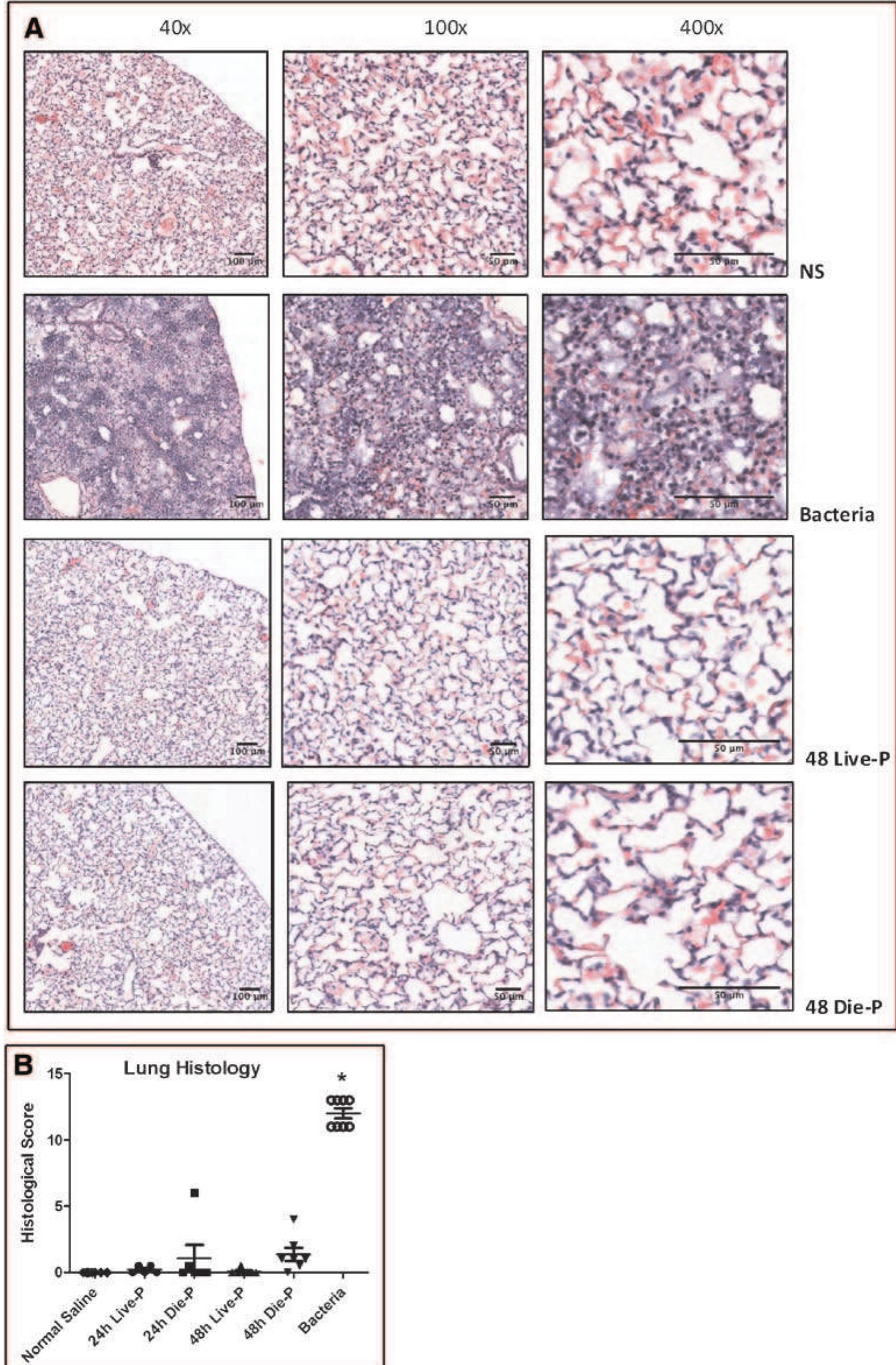 Figure 7 - Cecal Ligation and Puncture-Induced Murine Sepsis