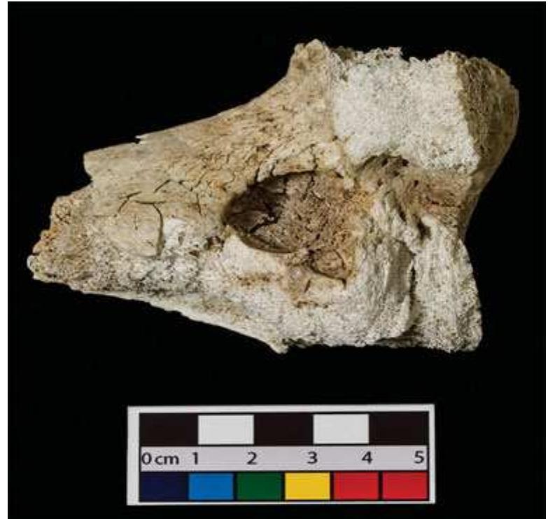 A defect in the popliteal fossa on the back of a femur. the