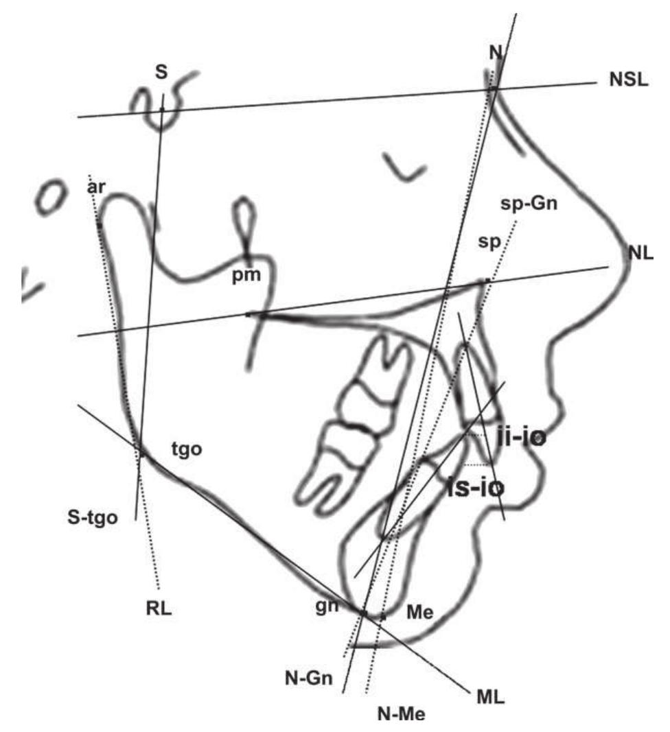 Cephalometric landmarks and abbreviations. articulare (ar),