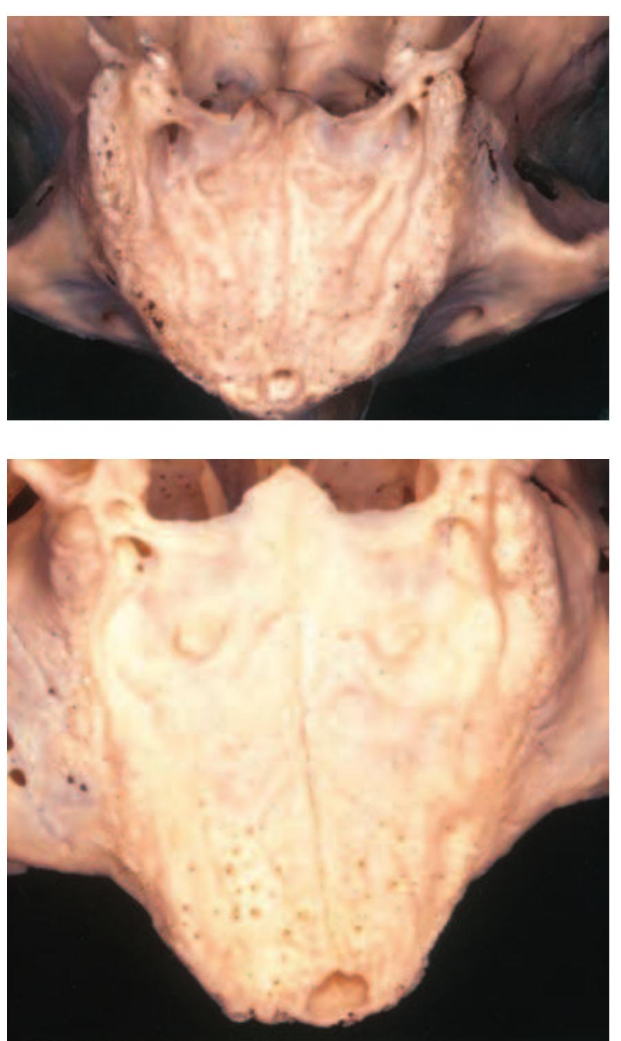 S 3 and 4. occlusal aspect of two edentulous maxillae. the