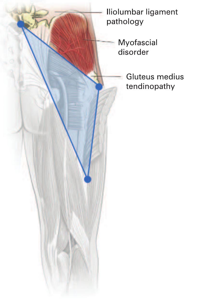 Superior to the gluteal triangle.