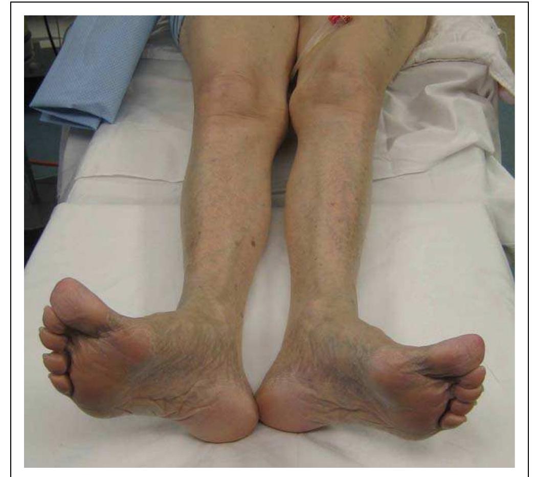 |. clinical photograph of the lower extremities of a patient