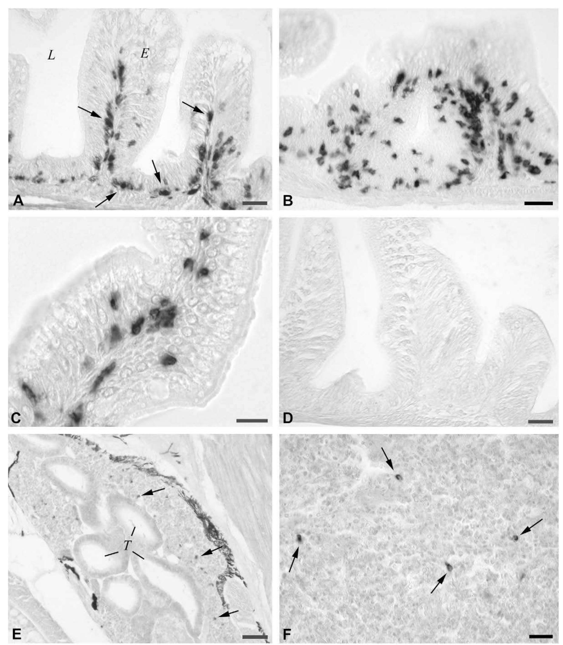 Immunohistochemistry of posterior intestine, kidney and