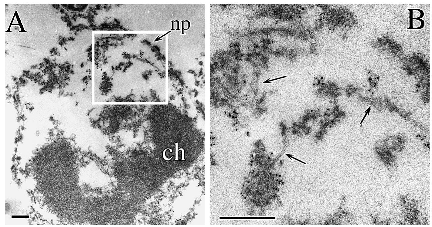 Immunoelectron microscopic localization of y-tubulin in