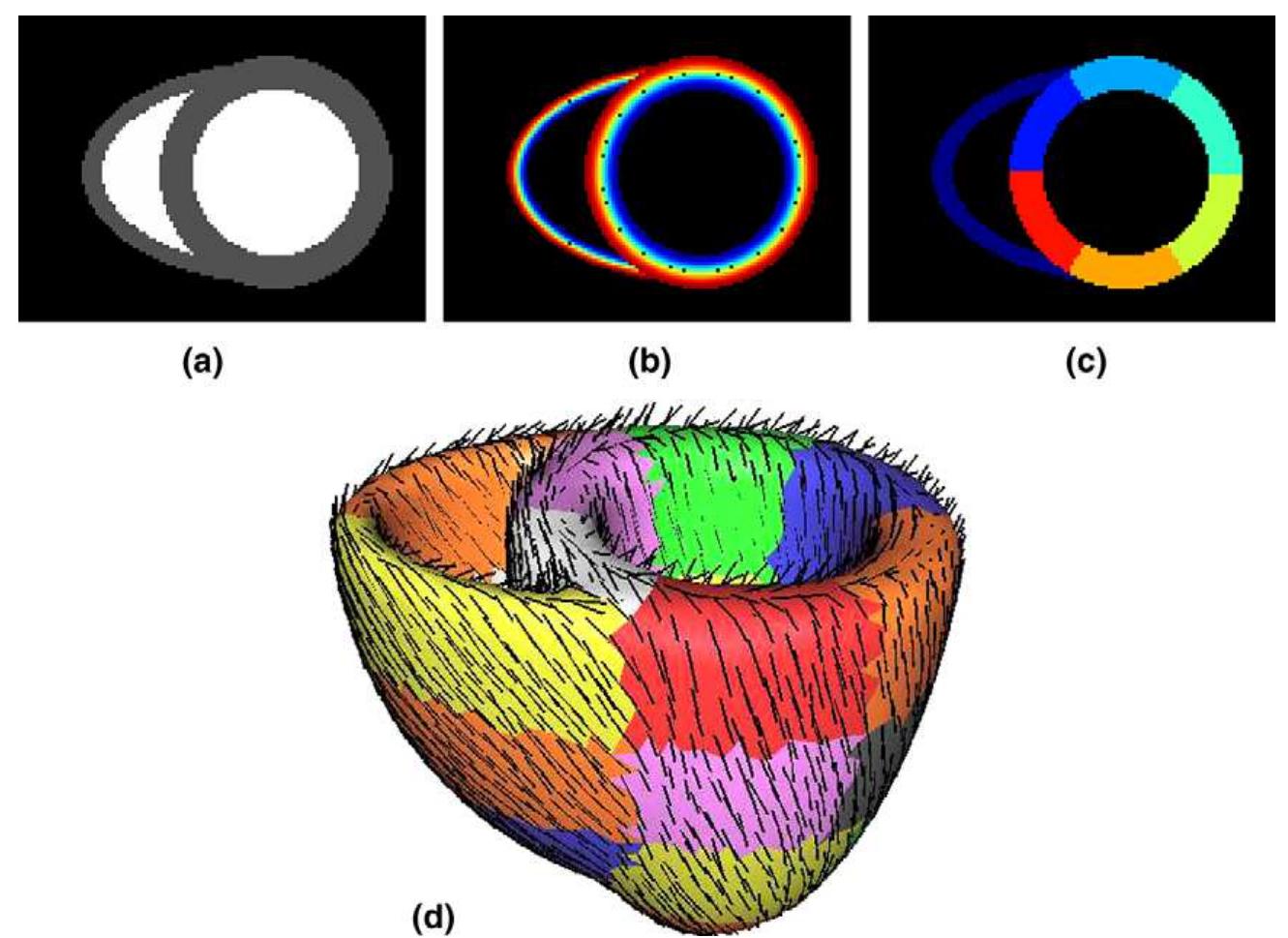 Generic anatomical bi-ventricular model: equatorial short
