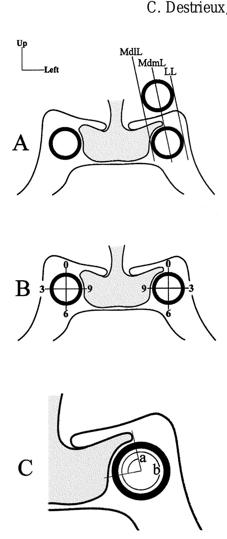 Fic. 11. drawings showing the three methods defined by