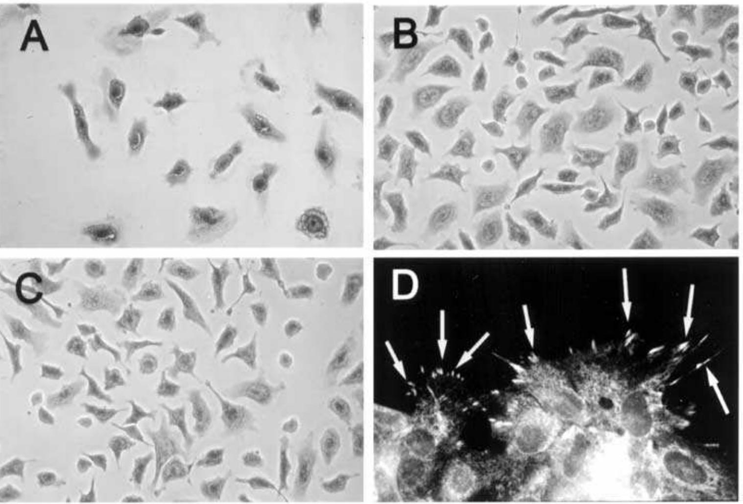 Cell morphology (a-—c) in mouse skin keratinocyte cultures