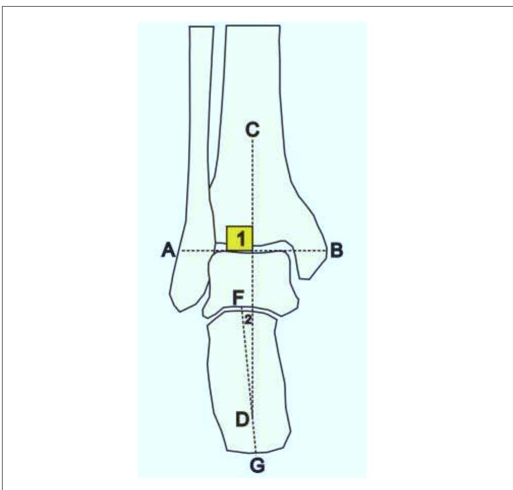 A diagram of the ankle and foot showing the measurements