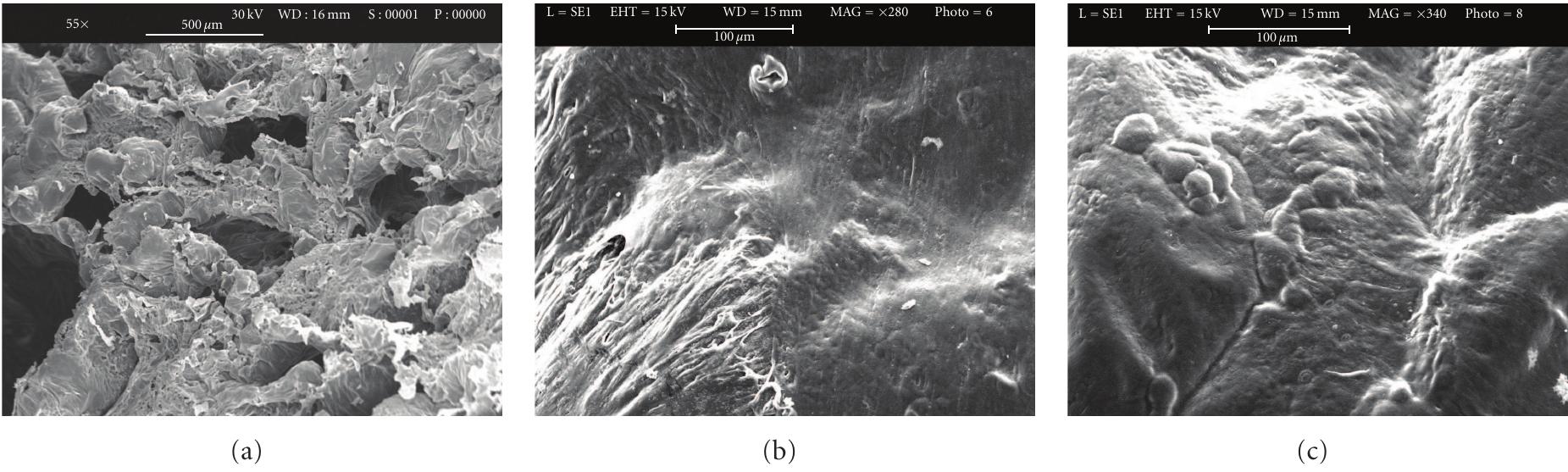Scanning electron microscopic images of unseeded plga