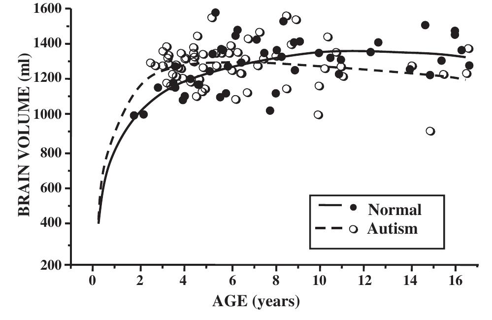 - brain growth in autism through 16 years. data plot shows