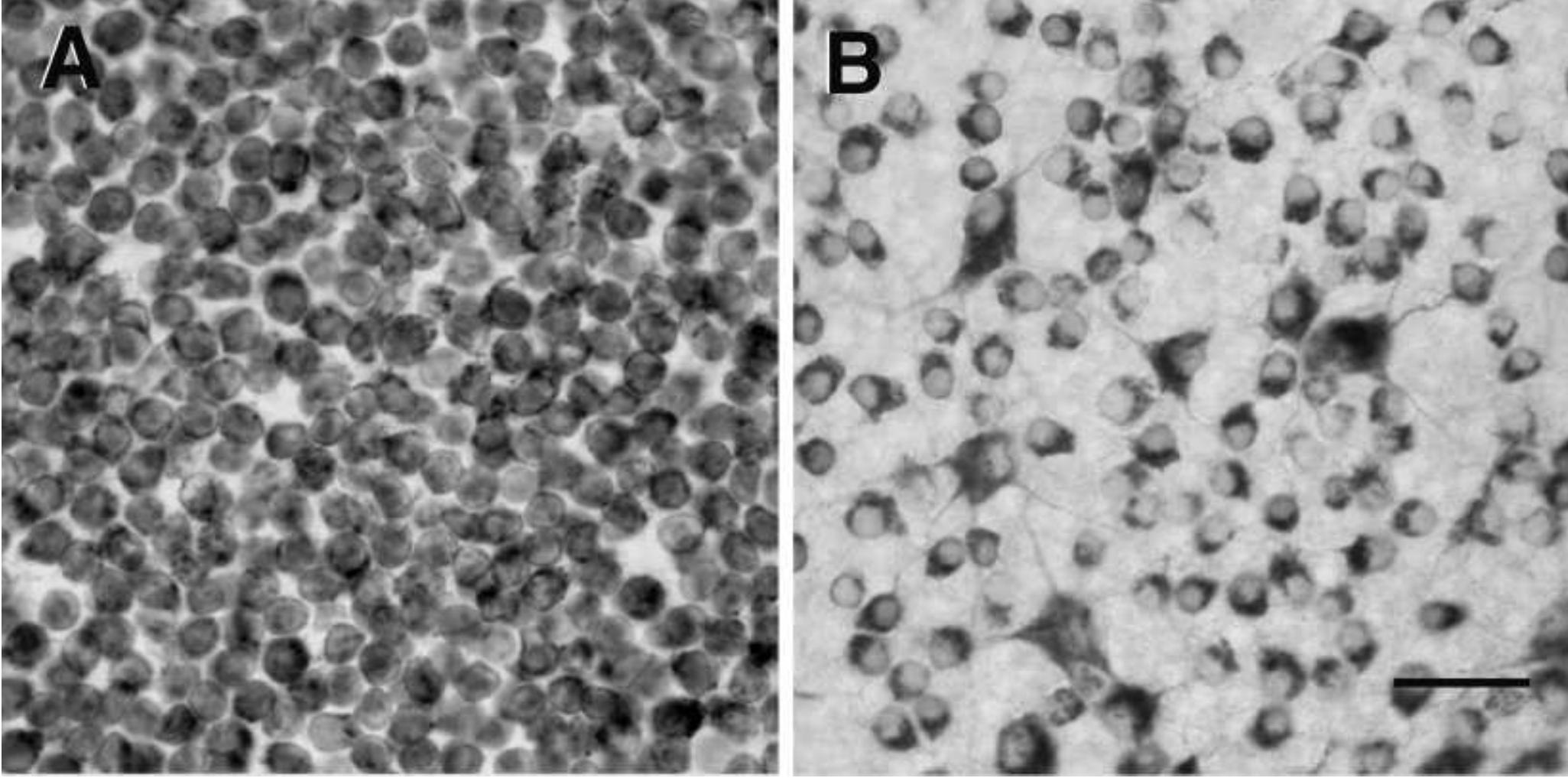 Retinal ganglion cells labeled following cholera toxin b
