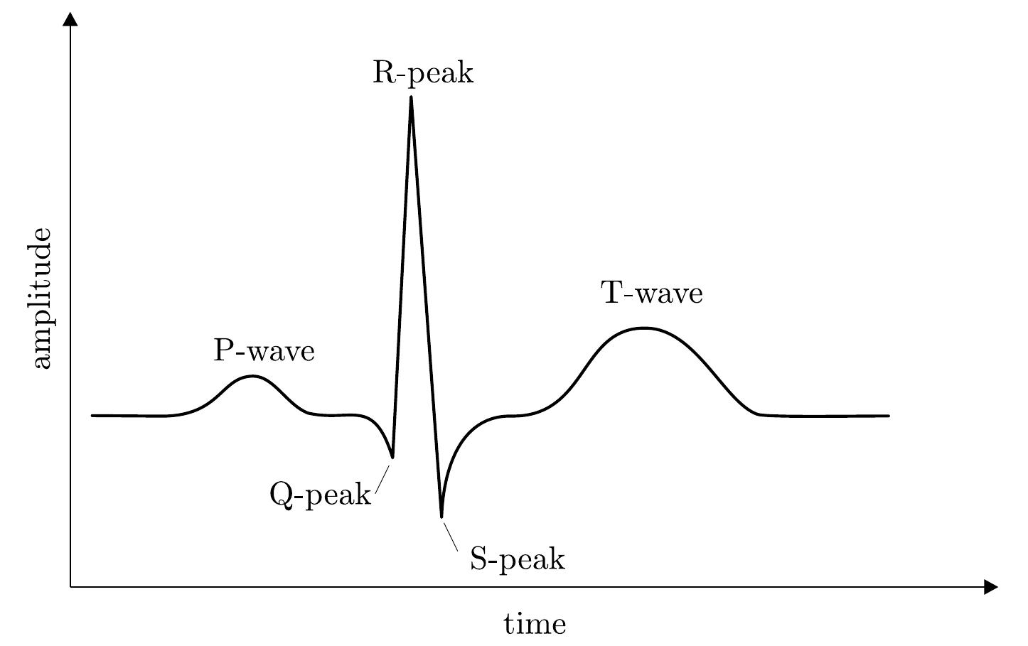 7: schematical cardiac signal with standard labelling of the