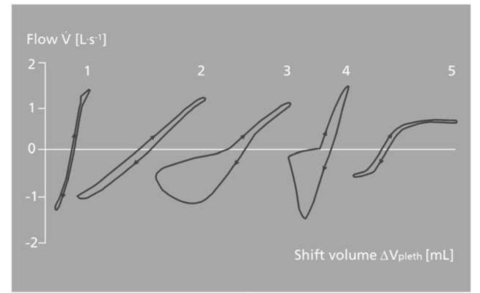 Figure 3 - from Body plethysmography--its principles and