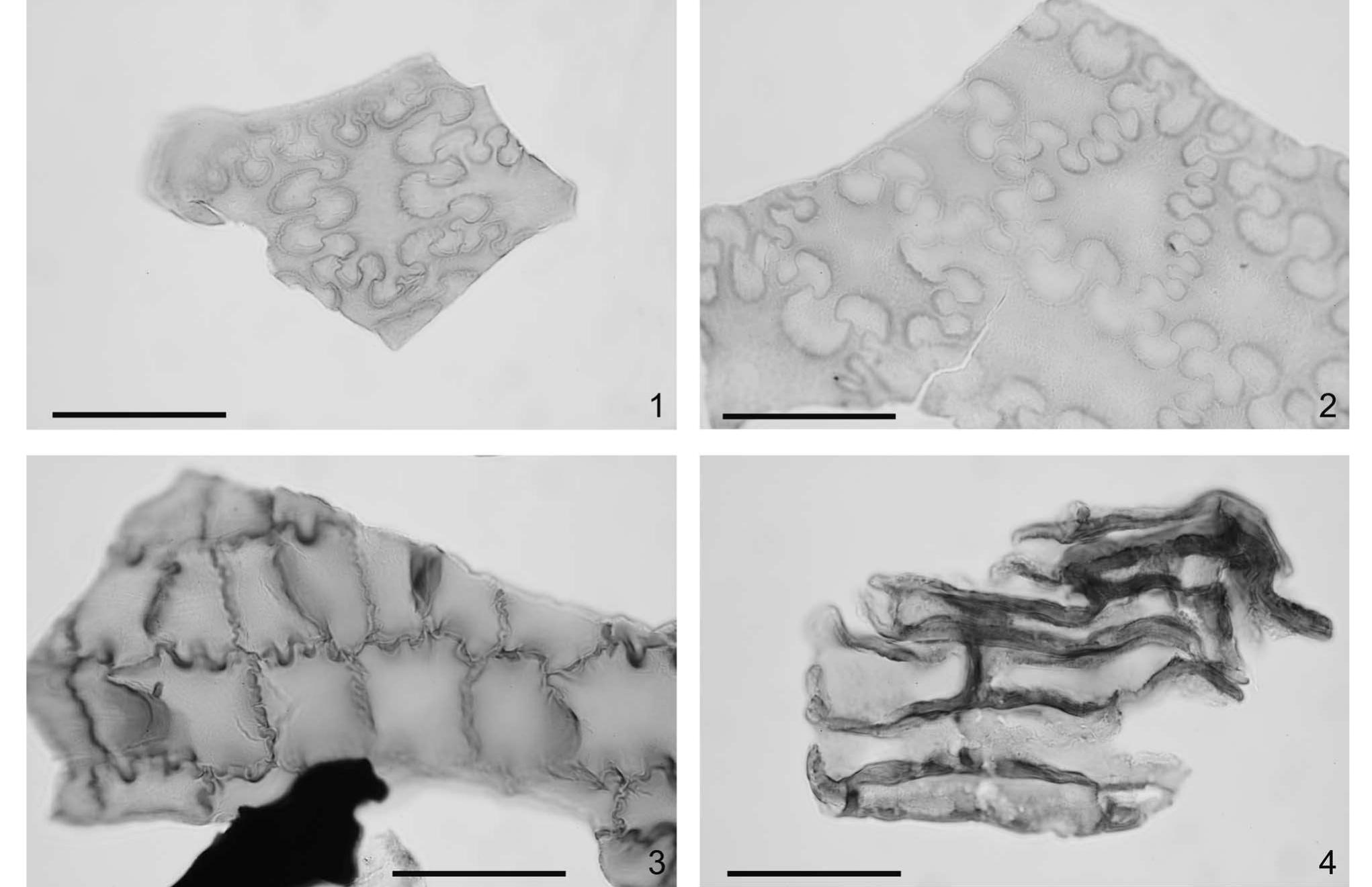 Cuticles from bailey quarry bq 4, sample p39160. see the
