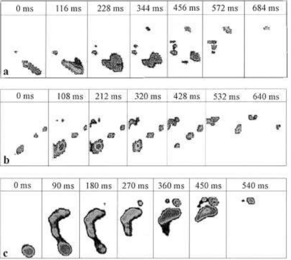 Examples of roll-off patterns of left foot during qua-