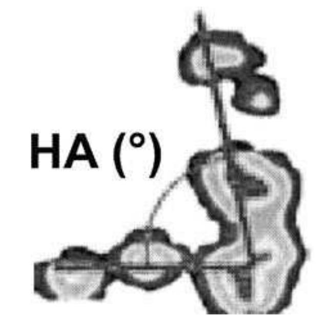 Degree of hallucal abduction (ha): angle between first ray