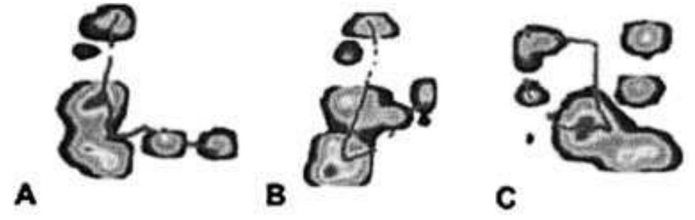 Figure 8 - from Functional analysis of the gibbon foot