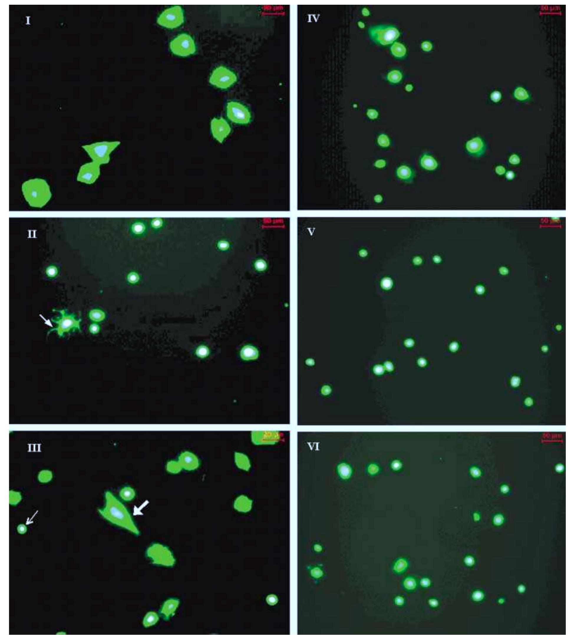 Human dermal neonatal fibroblast cells, stained with