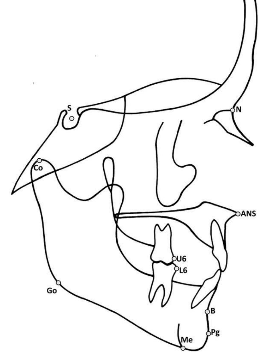 Cephalometric landmarks digitized. ans, anterior nasal