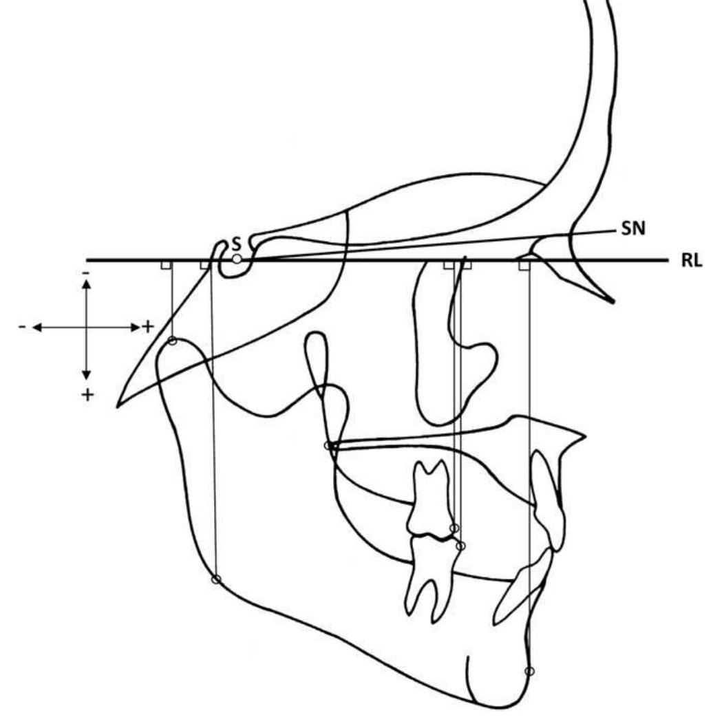 Horizontal and vertical distances of the landmarks from the