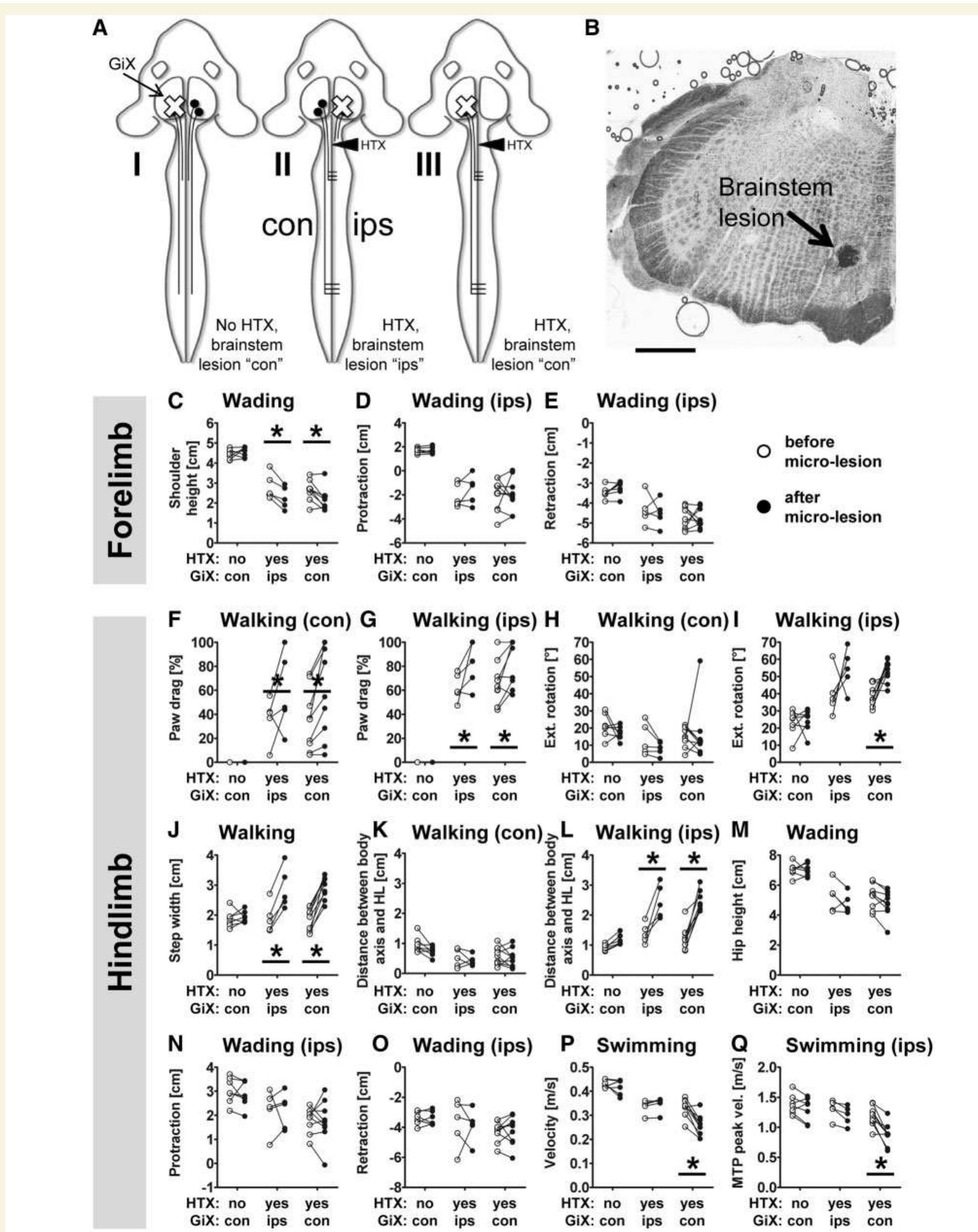 Lesioning of the gigantocellular reticular nucleus in