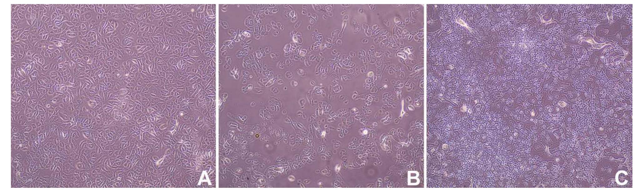 - nhek cells showing (a) normal morphology (polygonal shape,
