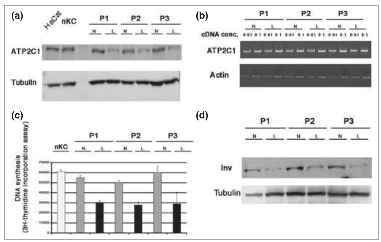 A a ee hhd cutaneous lesions. total cell extracts were