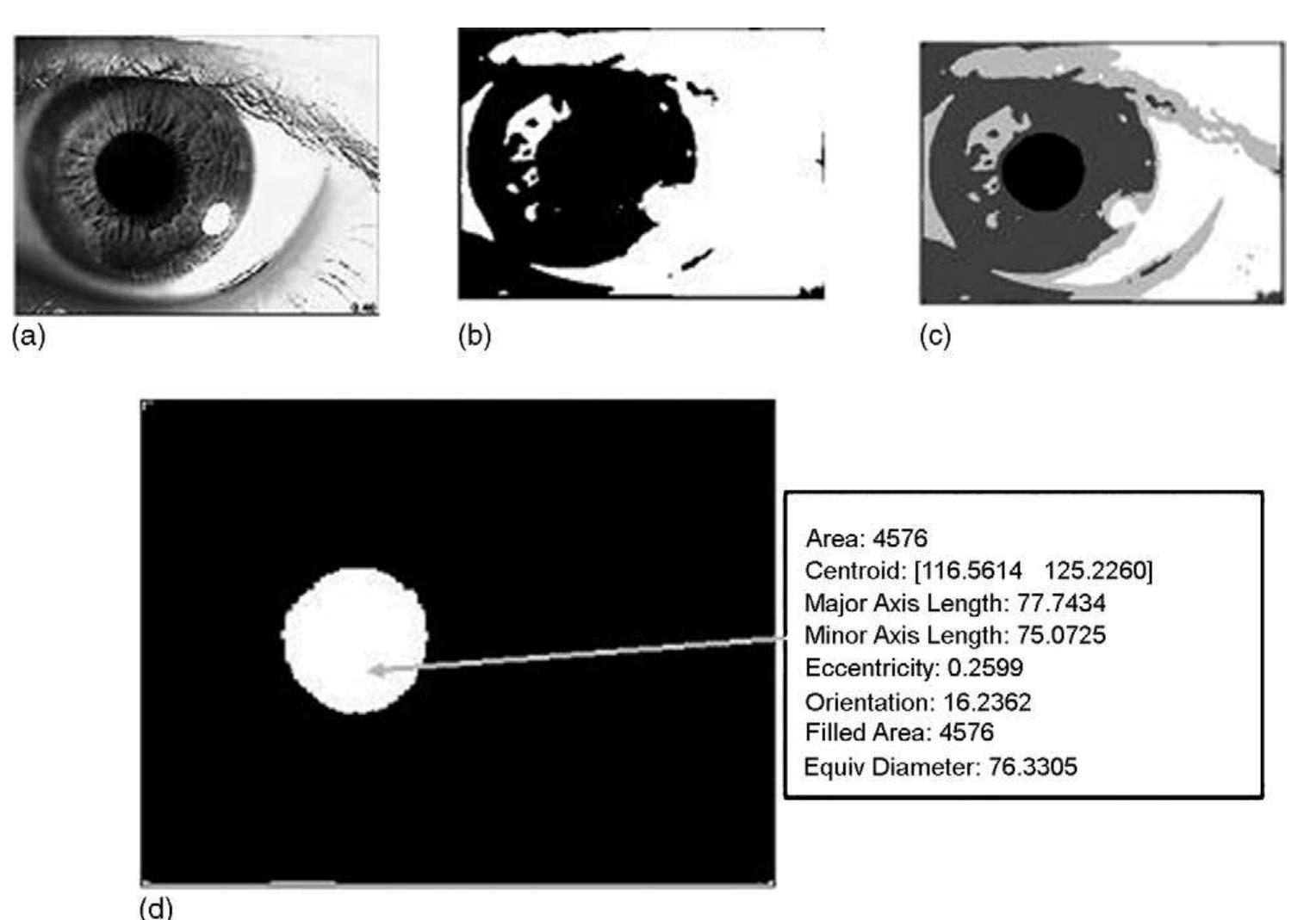 algorithm outcome on a typical pupil picture in normal