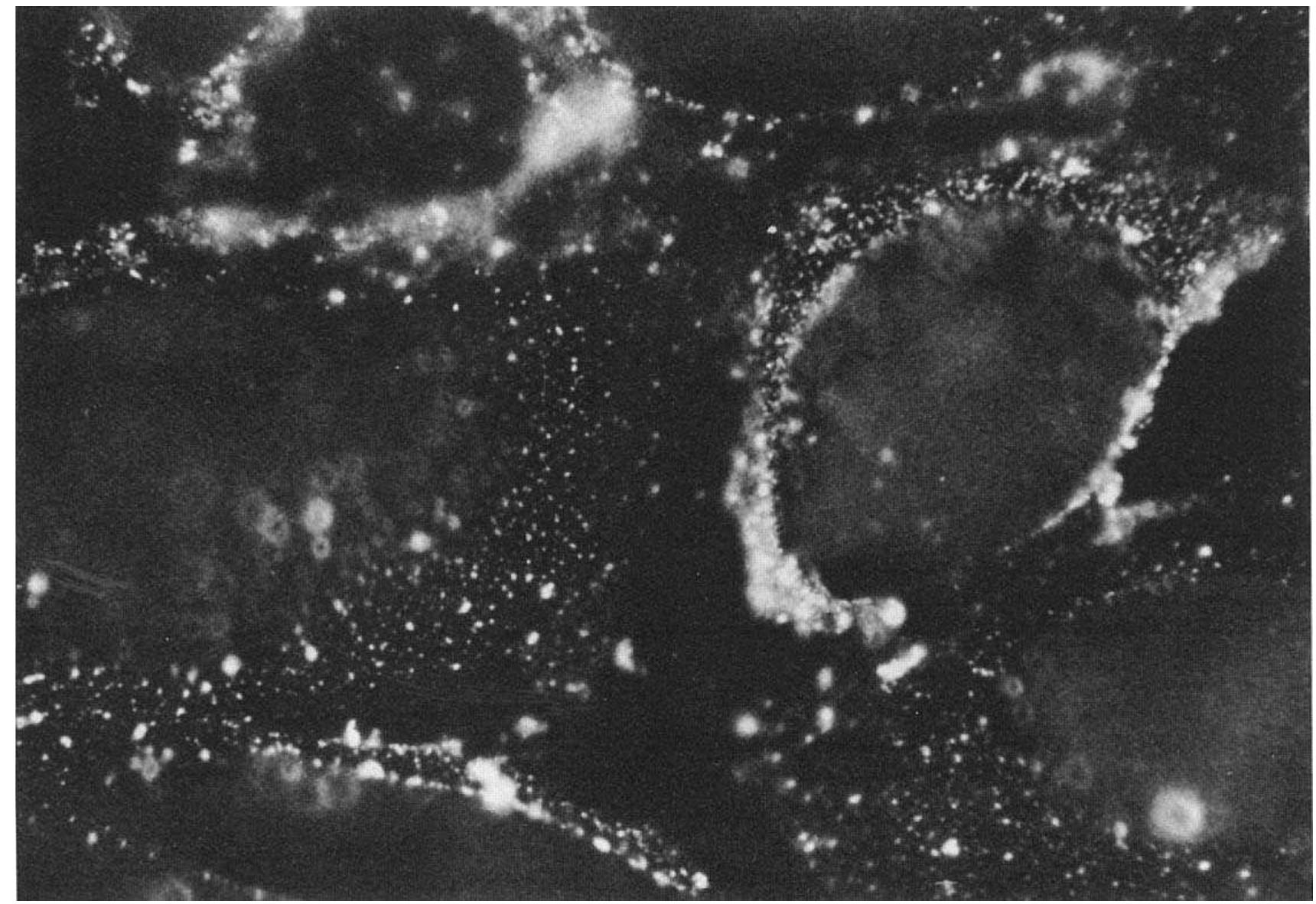 The immunofluorescence micrograph shows fine granular
