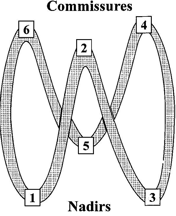 Anatomy of aortic annulus and marker placement. the aortic