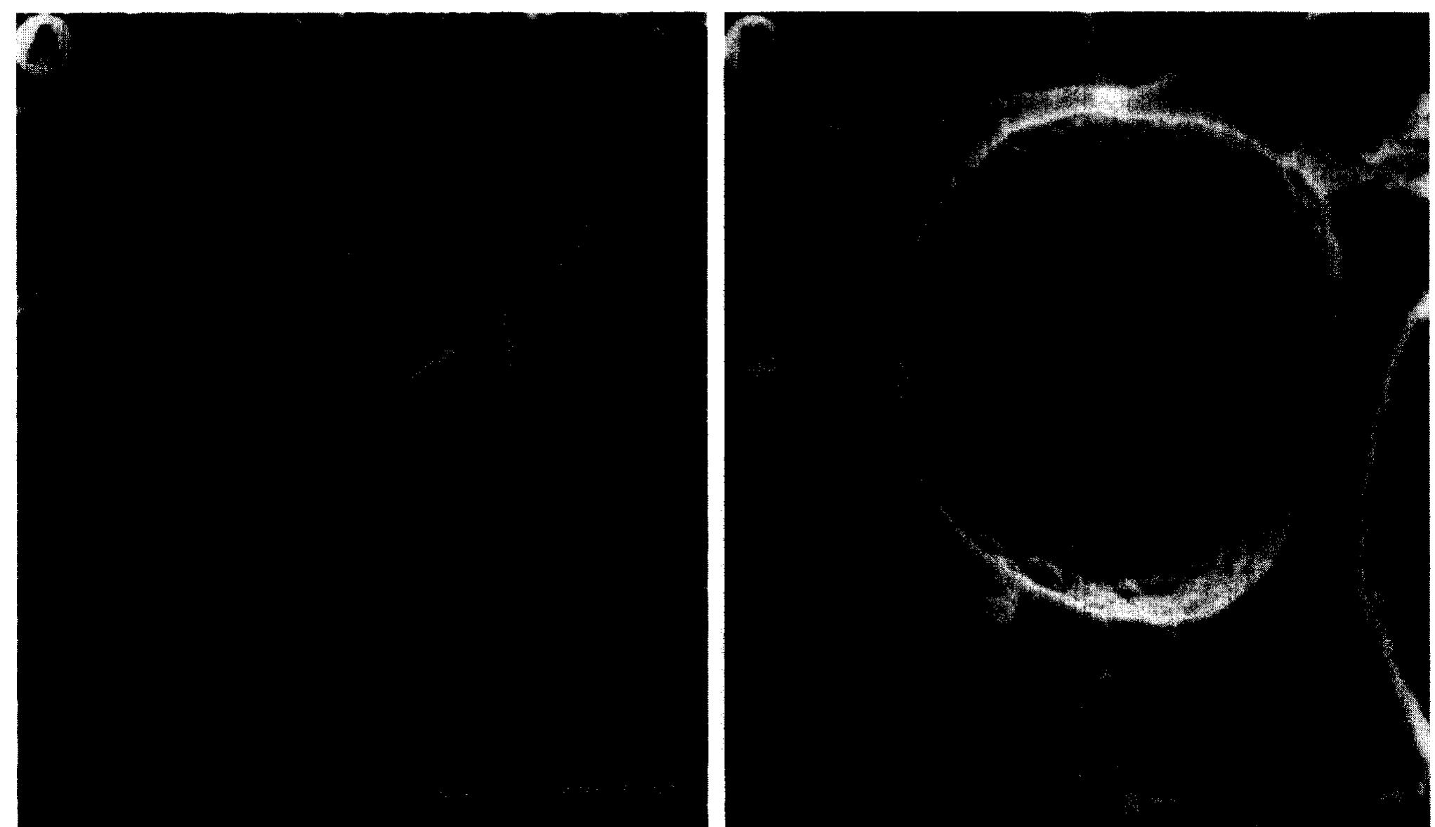 A: cryo-sem micrograph showing the four phases of ice cream.