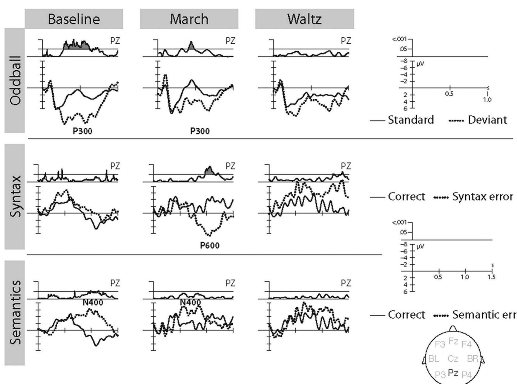 Displayed from left to right at a sample electrode (pz) are