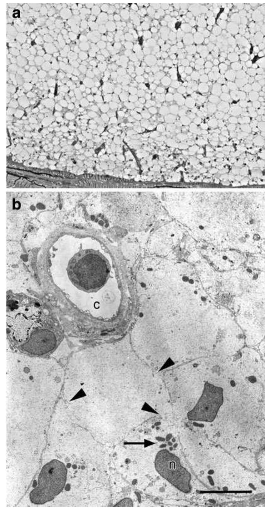 Histology and ultrastructure of the nuchal glands of rhabdo-