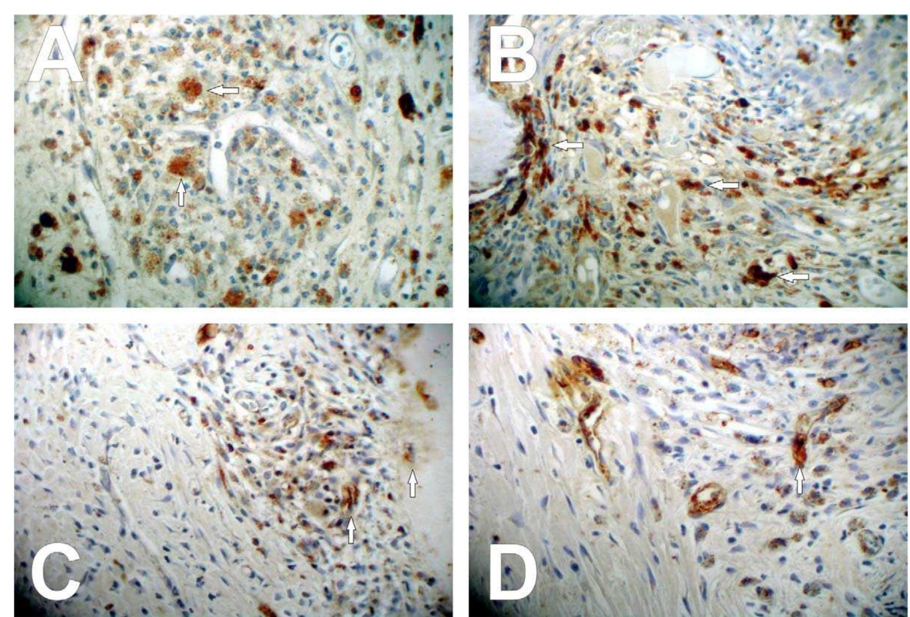 - inflammatory periapical lesions development. mmp-2 and -9