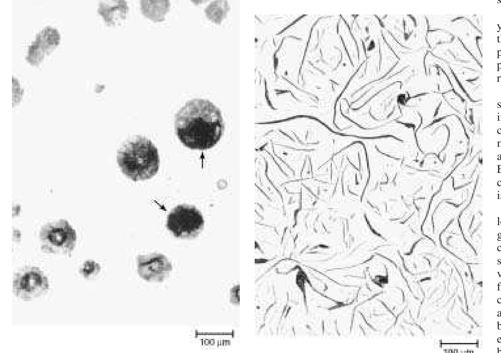 (PDF) Metallography and Microstructures of Cast Iron