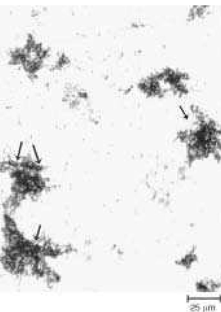 (PDF) Metallography and Microstructures of Cast Iron