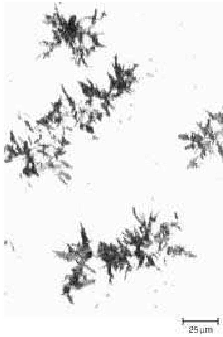 Figure 5 - Metallography and Microstructures of Cast Iron
