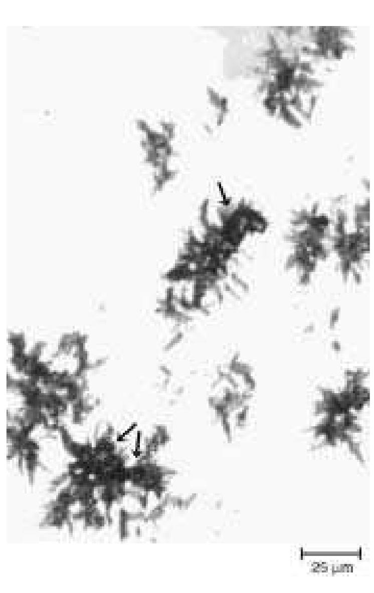 (PDF) Metallography and Microstructures of Cast Iron