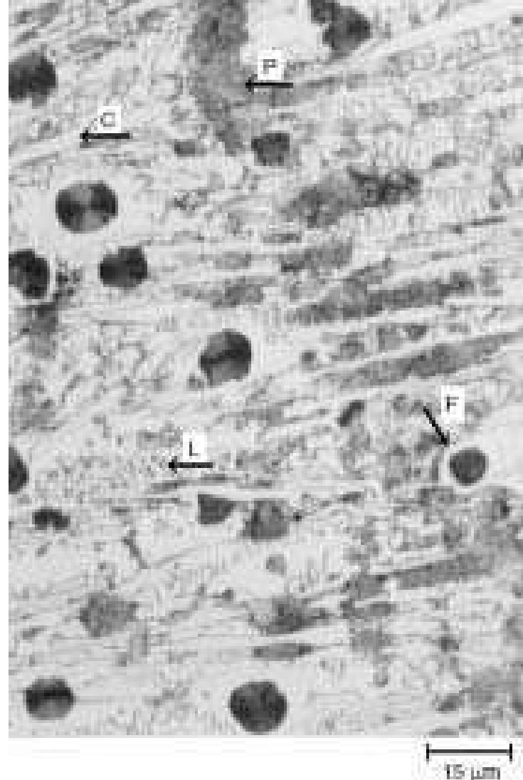 (PDF) Metallography and Microstructures of Cast Iron