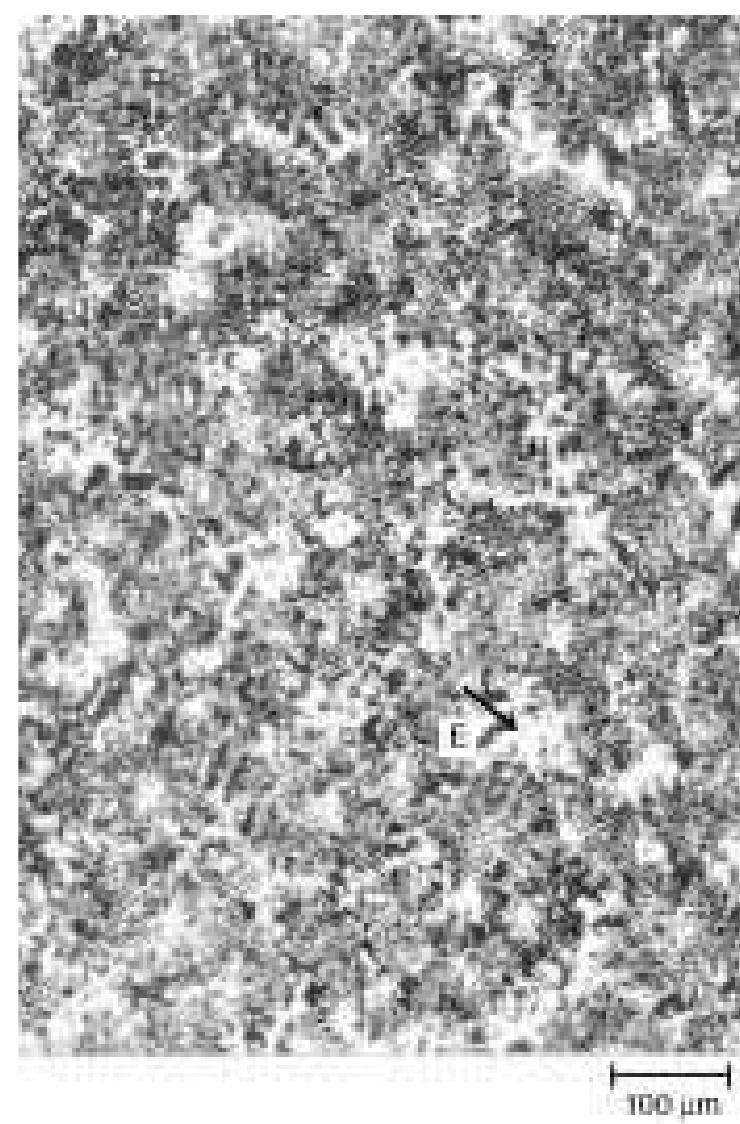 (PDF) Metallography and Microstructures of Cast Iron