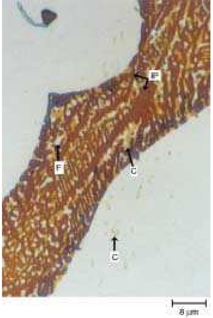(PDF) Metallography and Microstructures of Cast Iron