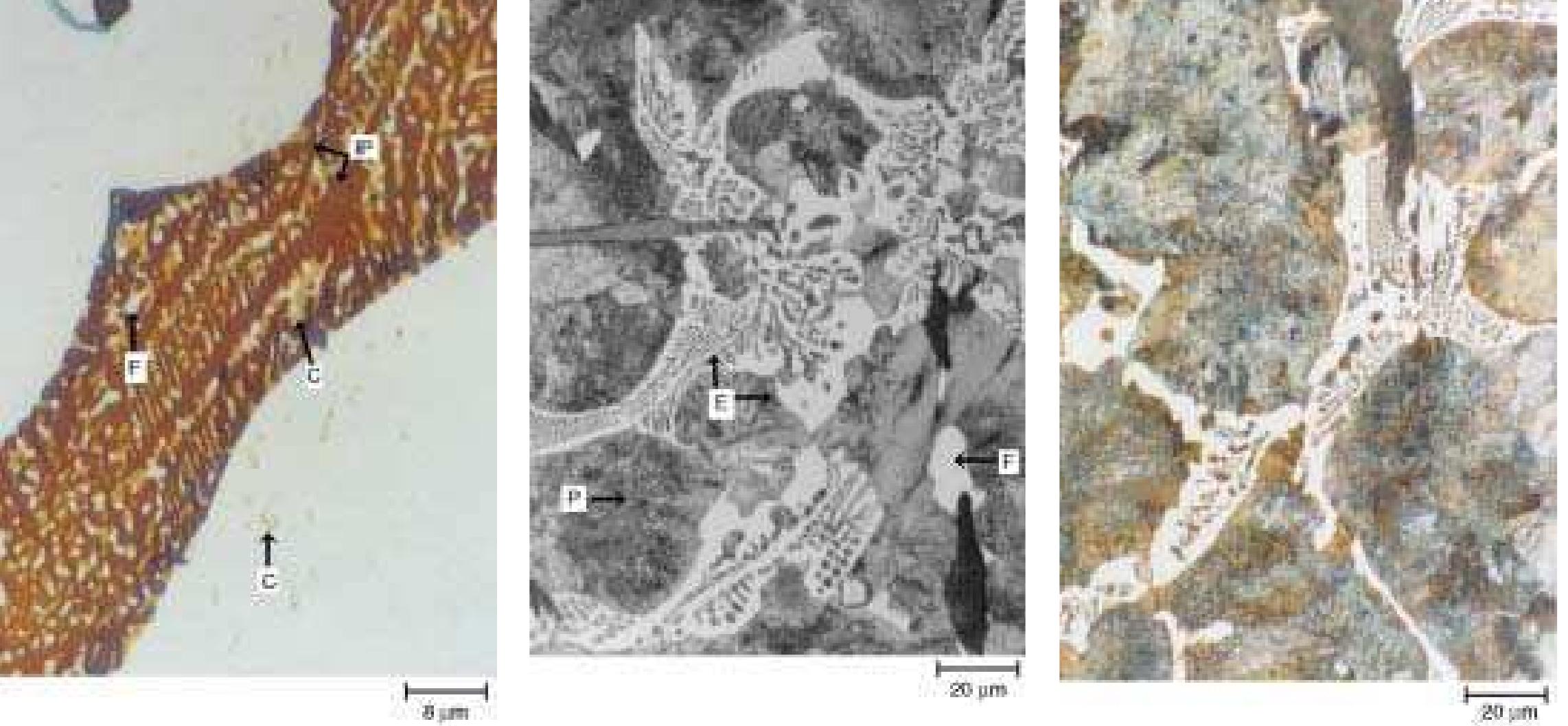 (PDF) Metallography and Microstructures of Cast Iron