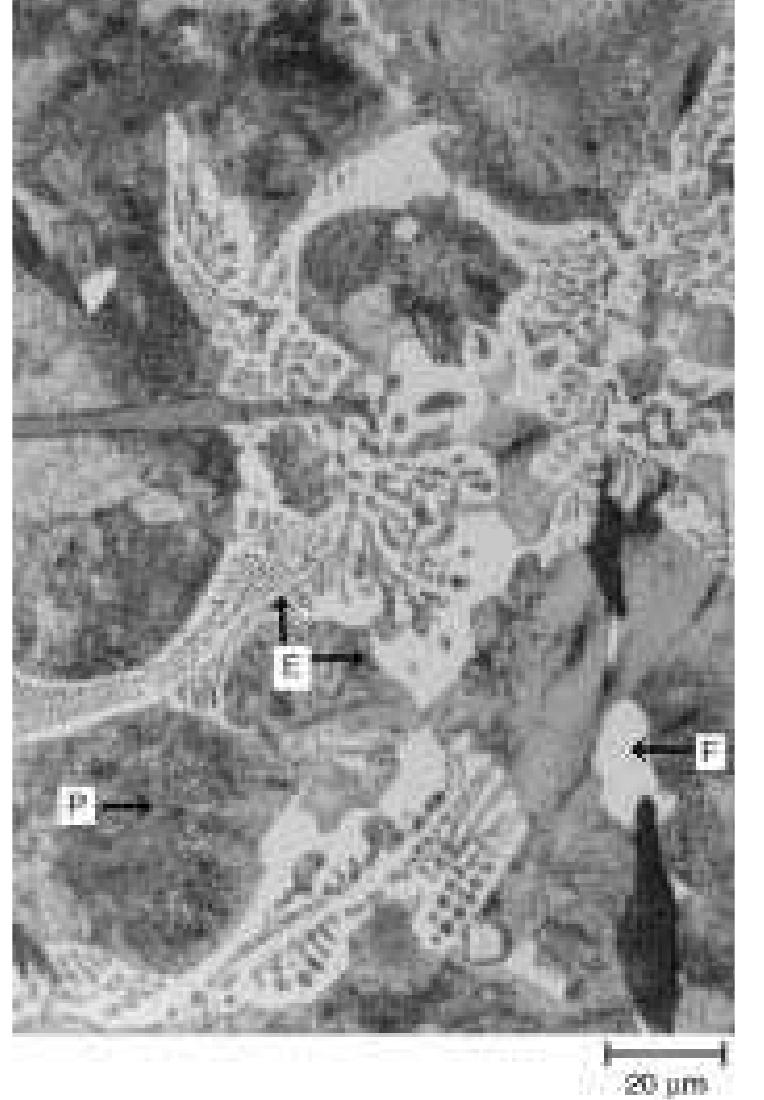 (PDF) Metallography and Microstructures of Cast Iron