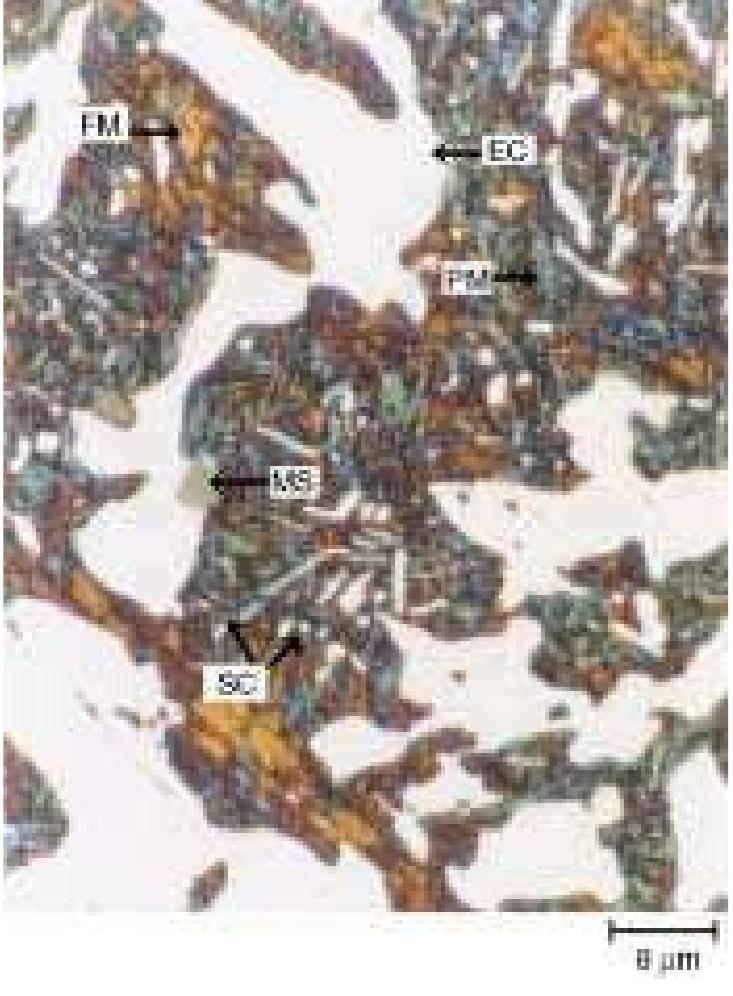 (PDF) Metallography and Microstructures of Cast Iron