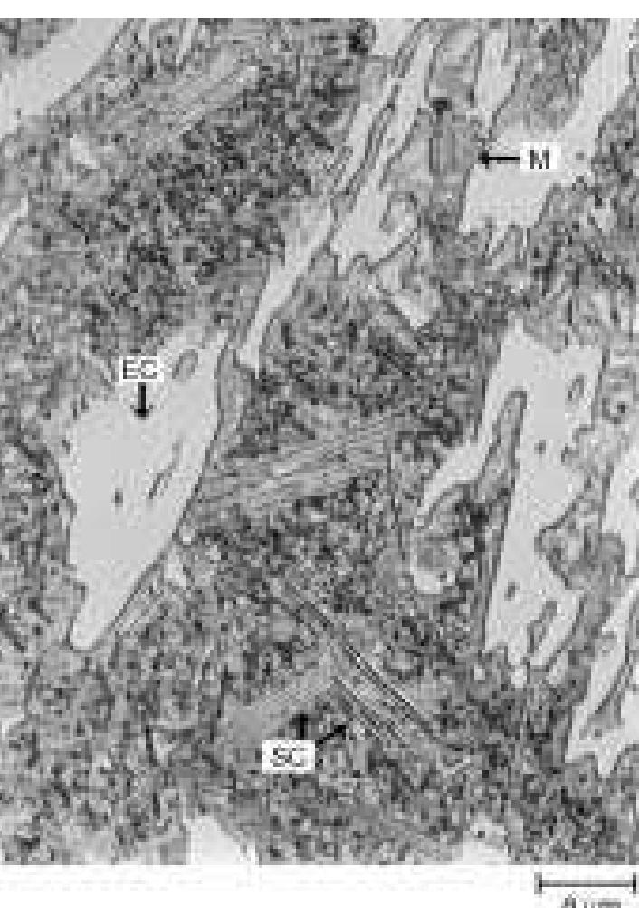 (PDF) Metallography and Microstructures of Cast Iron