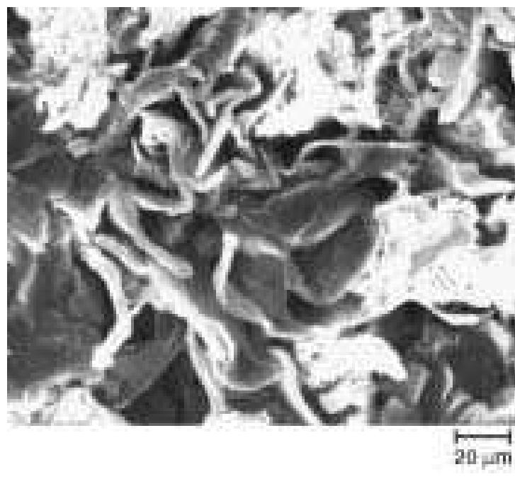 (PDF) Metallography and Microstructures of Cast Iron